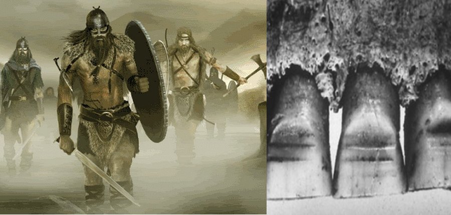 Vikings Filed Their Teeth For Unknown Reasons - MessageToEagle.com