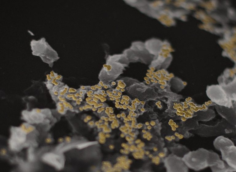Tough Bacteria That Turns Toxic Chemicals Into 24-Karat Gold ...