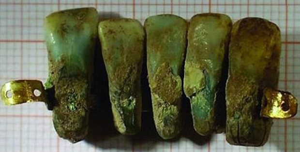 Unique Dental Prosthesis Made Of Human Teeth Found In Medieval Tomb ...